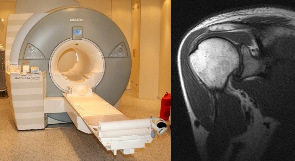 Schulter - Ihr Orthodpäde Stuttgart in Stuttgart