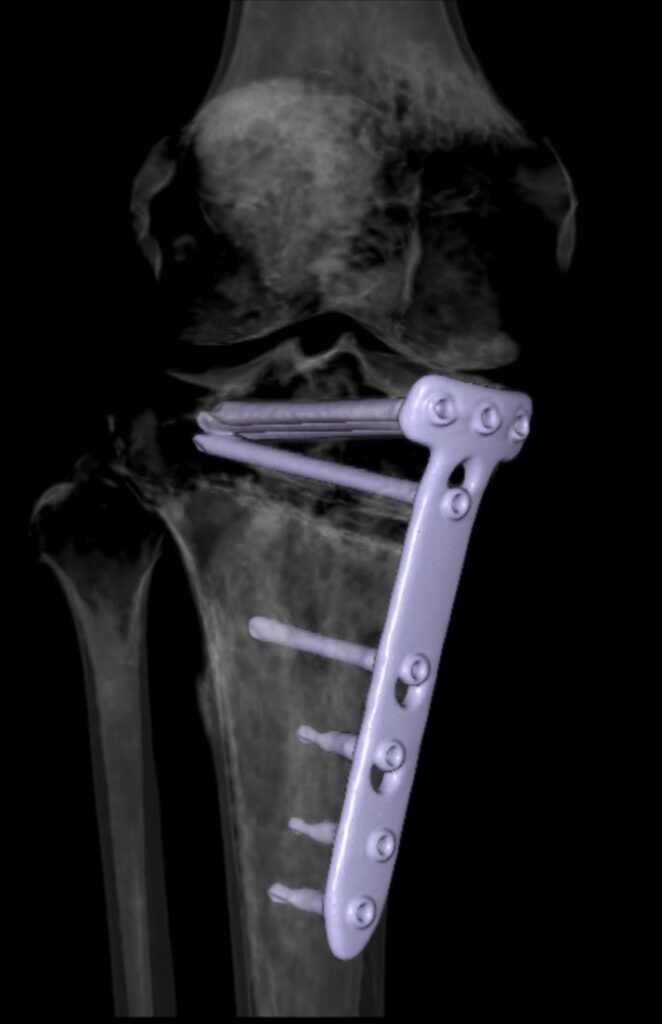 Knie - Ihr Orthodpäde Stuttgart in Stuttgart